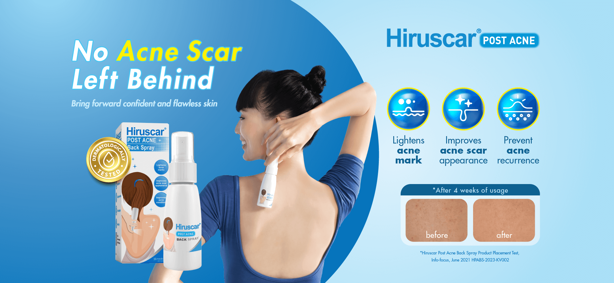 Hiruscar Post Acne Back Spray | Hiruscar Malaysia