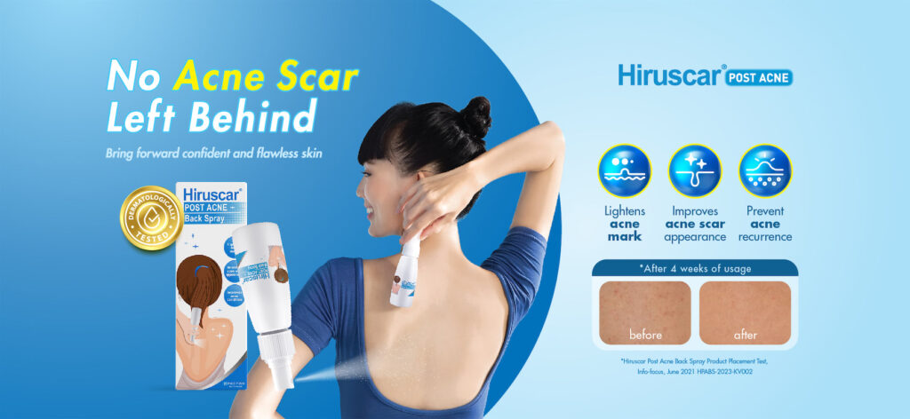 Hiruscar Post Acne Back Spray | Hiruscar Malaysia